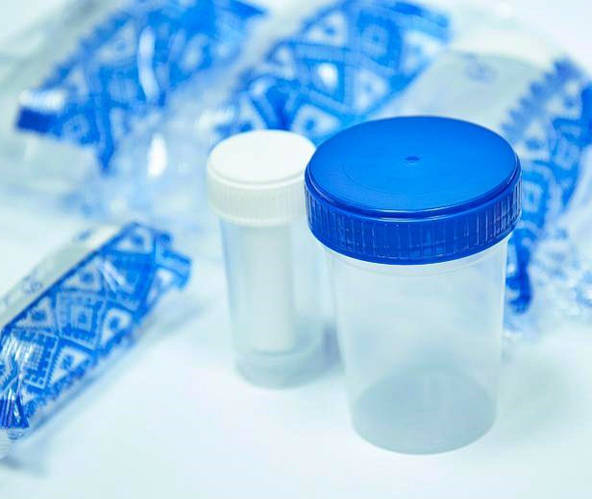Емкость для забора кала, 25 мл (нестерильная), цена 2 грн — Prom.ua (ID ...