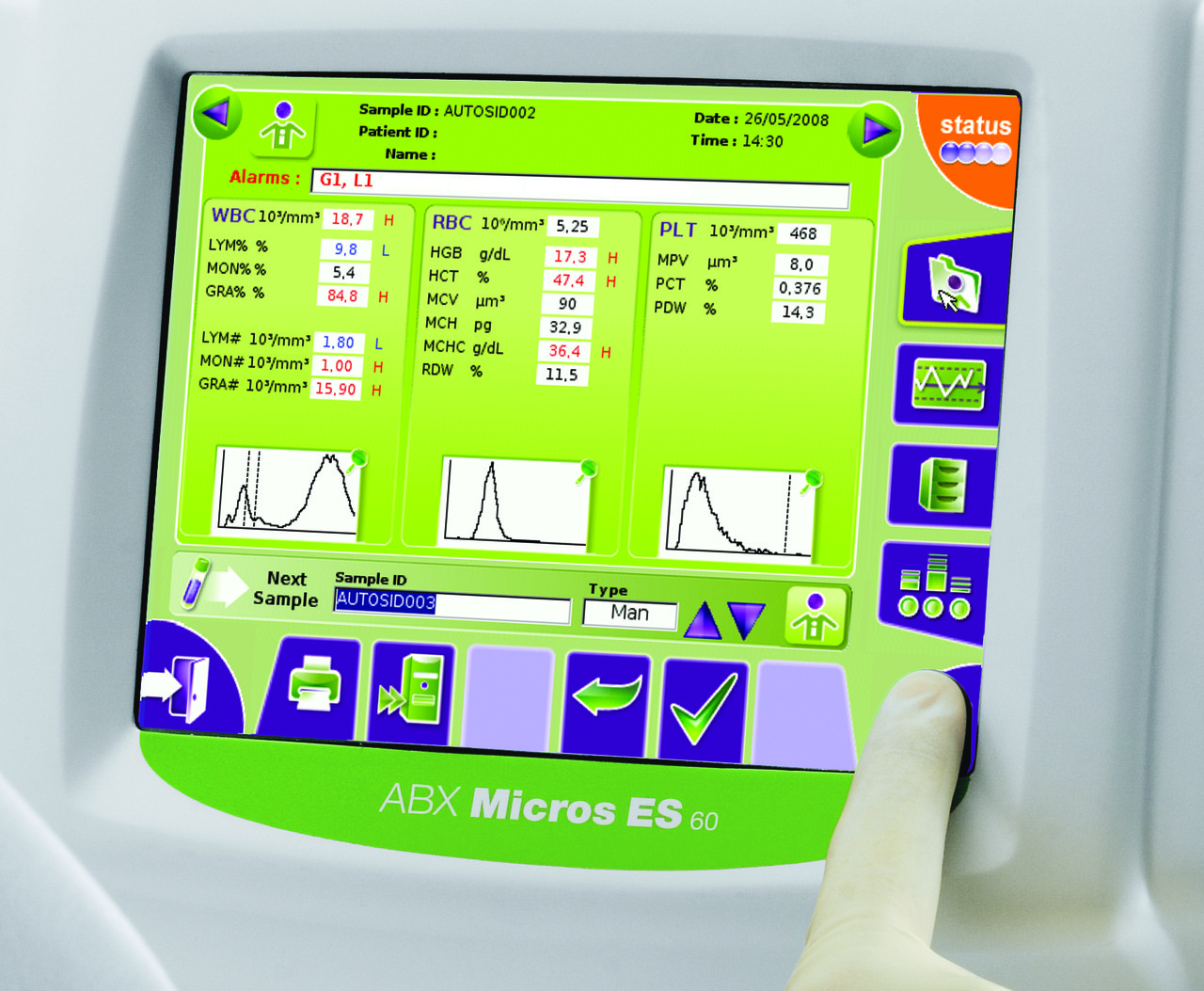 Автоматический гематологический анализатор ABX Micros ES60, цена 310000 ...