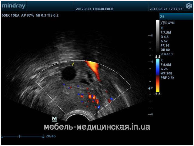 Портативний узд MindRay Z5, ціна 318920 грн — Prom.ua (ID#74954412)