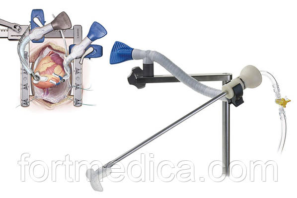 Octopus 4 Medtronic Minimally Invasive Coronary Artery Bypass