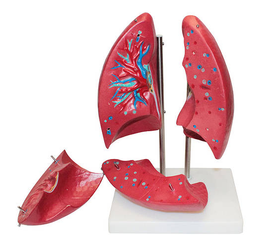 Купити Модель "Легені людини", ціна 5300 ₴ - Prom.ua (ID# 1140377011)