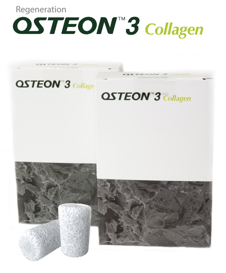 Купити OSTEON 3 Collagen (Остеон 3 Колаген), 0.28куб.см, розм.: 6мм х 10мм, № ND3CC061 ...
