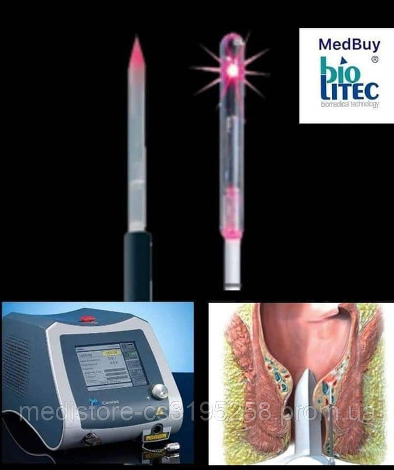 FiLaC світловод для лазерне лікування анальних свищів (ID#1192812501 ...