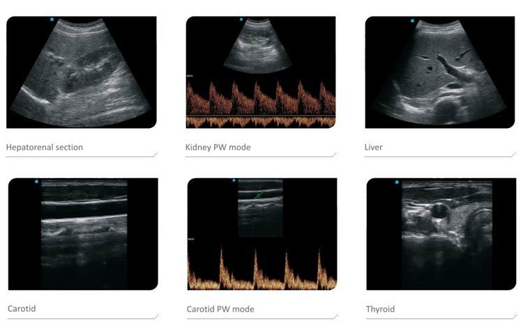Купить Ультразвукова діагностична система CTS-7700, цена — Prom.ua (ID ...