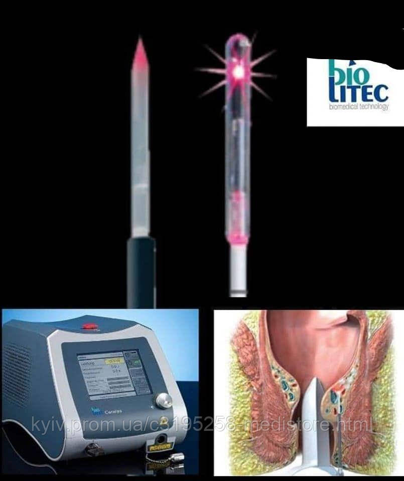 Лазерная хирургическая система CERALAS E15 ELVES (Biolitec AG, Германия), цена - Prom.ua (ID ...