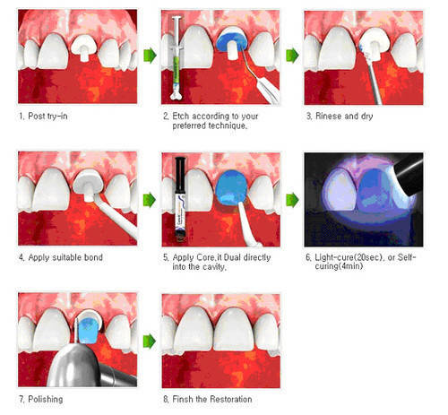 Купить Core-It Dual (Кор Іт Дуал) колір білий, Spident 10г х 2шприца ...