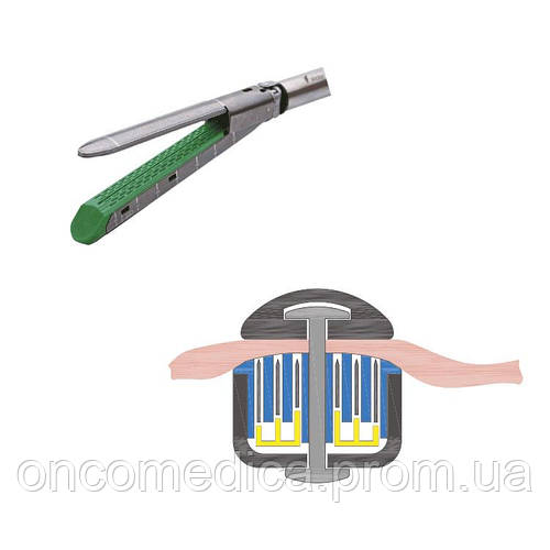 Купить Аппарат эндоскопический сшивающий одноразового использования ...