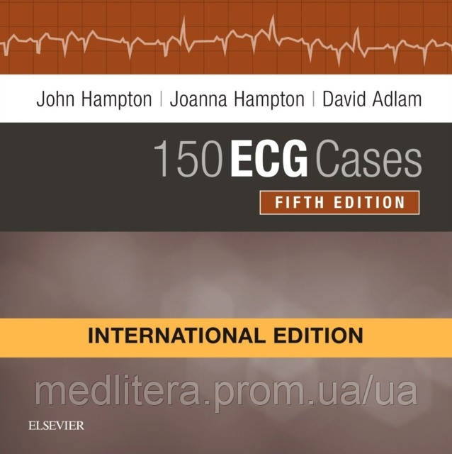 Купить 150 ECG Cases, International Edition, Hampton, John R 2019 год ...