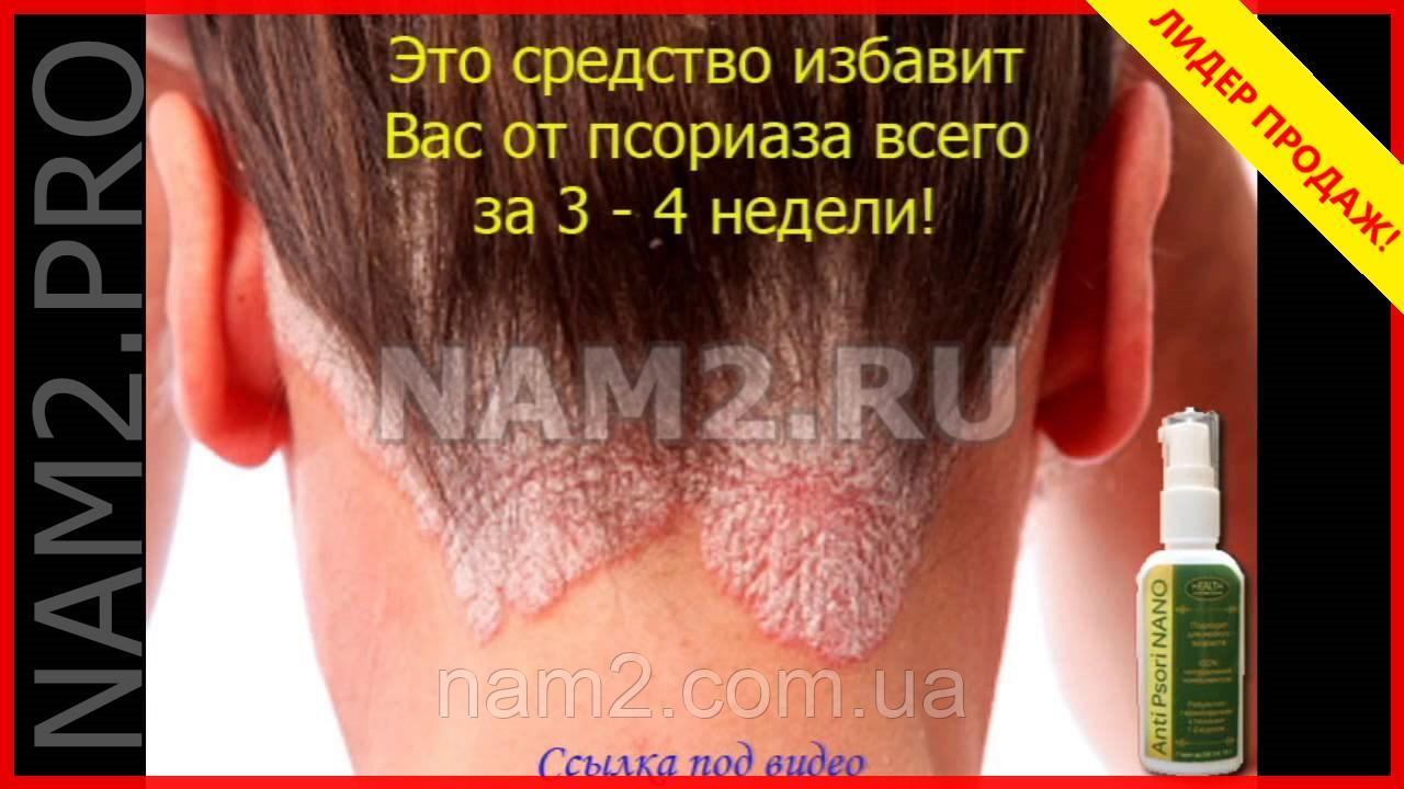Купить Anti Psori Nano - крем от псориаза (Анти Псори Нано), цена 119 ...