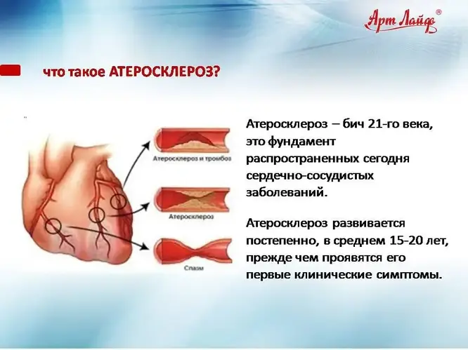 Атеростерол Арт Лайф помогает поддерживать холестерин на необходимом ...