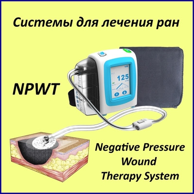 Системы для лечения ран NPWT - Negative Pressure Wound Therapy System ...