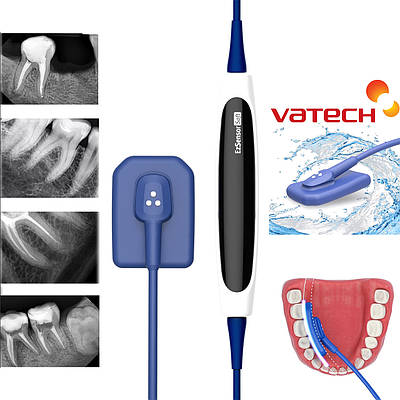 Vatech ezsensor | Сравнить цены и купить на Prom.ua