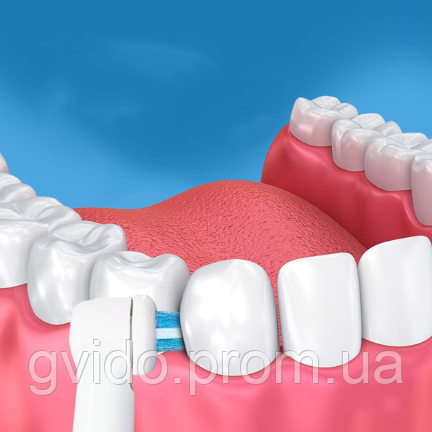 Насадка Power Tip Care на Зубную Щетку Oral-B для Брекетов / Насадка ...