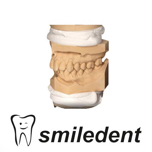 Купить Гипс артикуляционный MOUNT, белый, 20 кг. Артикуляционный гипс ...
