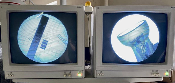 Купить Philips BV 25 (ЭОП 7") Рентген-аппарат (С-дуга), цена 246000 ...