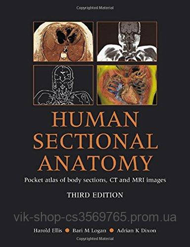 Human Sectional Anatomy : Third Edition Atlas of Body Sections, CT and ...