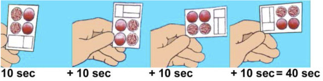 Купити Карти діагностичні Eldoncard 2521 для визначення групи крові AB0 ...