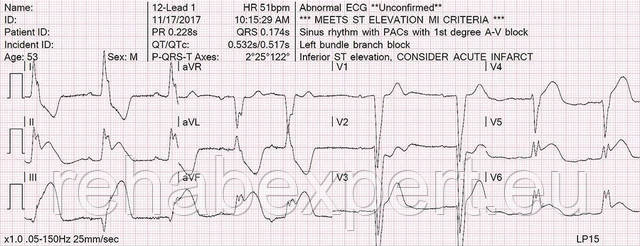 Монитор / Дефибриллятор Medtronic Physio-Control LIFEPAK 15 ...
