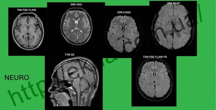 Магнитно-резонансный томограф UMR 570, цена 29500000 грн — Prom.ua (ID ...