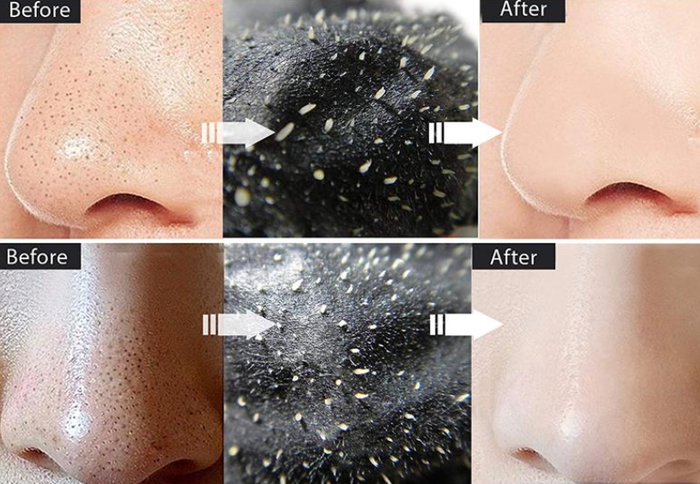 Купить Черная маска от прыщей и черных точек Bioaqua Black Mask ...