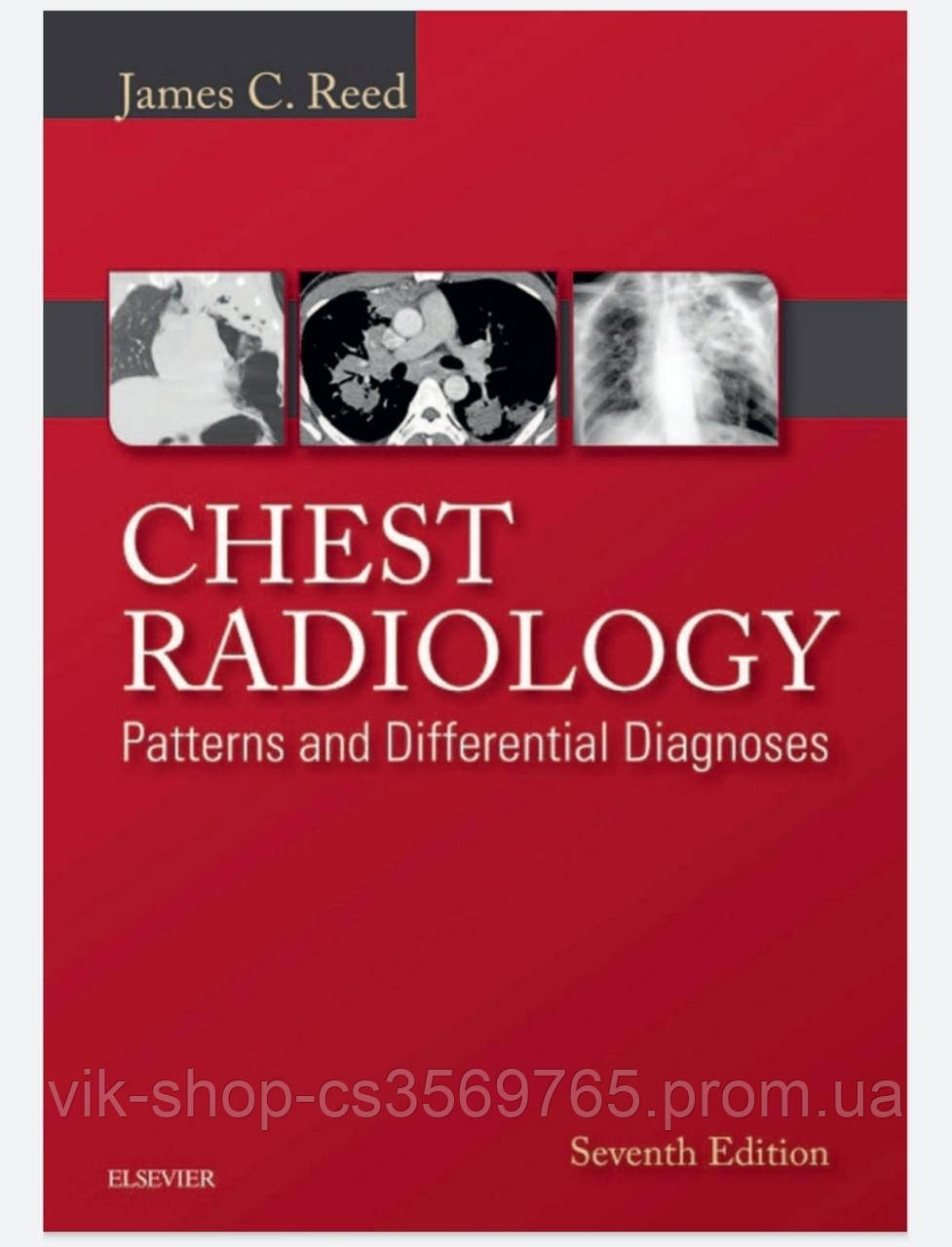 Chest Radiology: Patterns and Differential Diagnoses James C. Reed 2018 ...