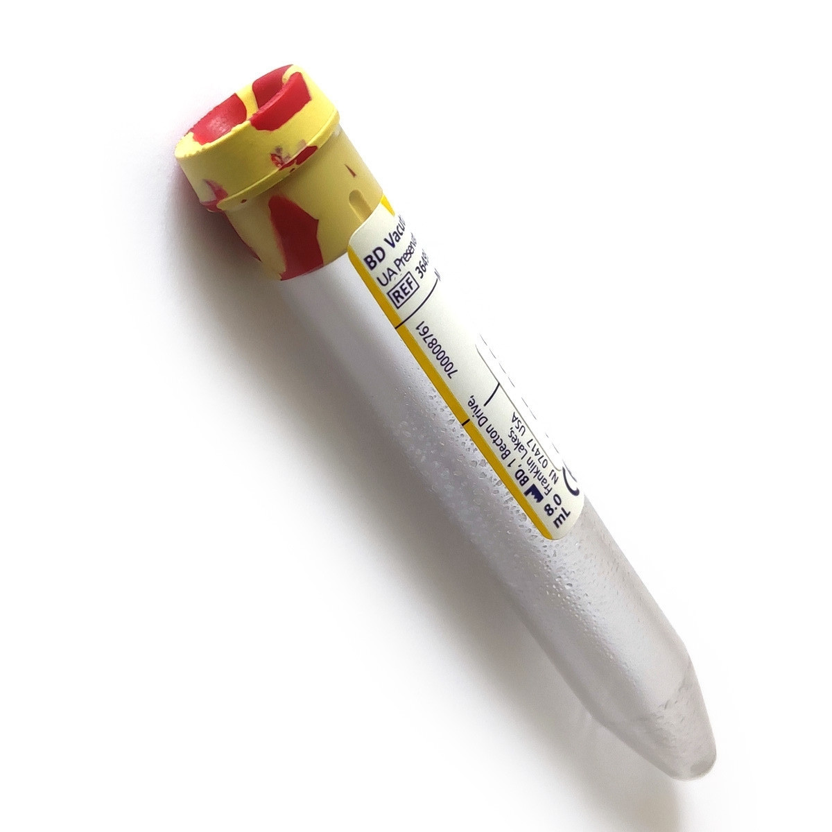 BD Vacutainer Urinalysis Tube 364992 Prime Dental Supply, 60% OFF