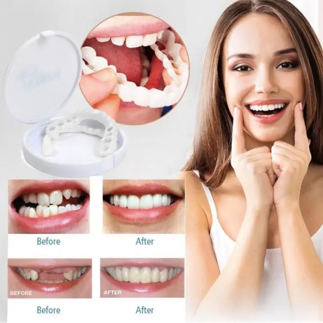 Купить Виниры Snapon Smile Veneers для зубов накладки на зубы Белые