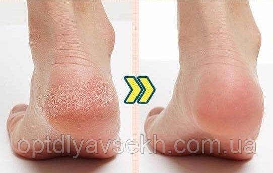 Кислотный Пилинг (250 Мл.) OPI Callus Remover для Педикюра — в ...