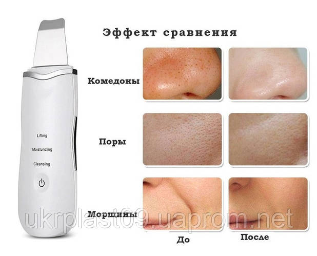 Ультразвуковой уз скрабер для чистки лица и омоложения кожи лифтинга и ...