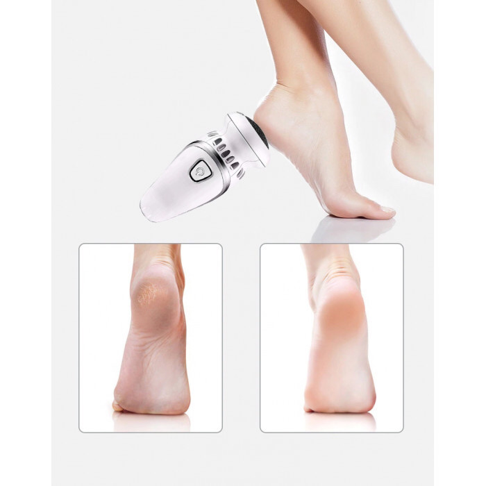 Купить Электрическая пемза для ухода за пятками Callus remover vacuum ...
