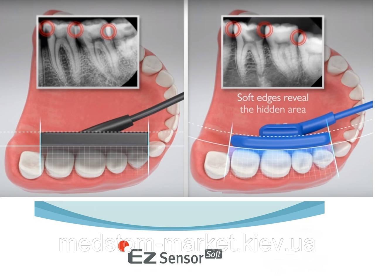 Радиовизиограф Vatech EzSensor Soft i - Гибкий Визиограф Модель 2022 - Новая программа Windows ...