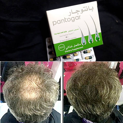 PANTOGAR Пантогар 90капсул(ЄГИПЕТ) для лікування і росту нігтів та ...