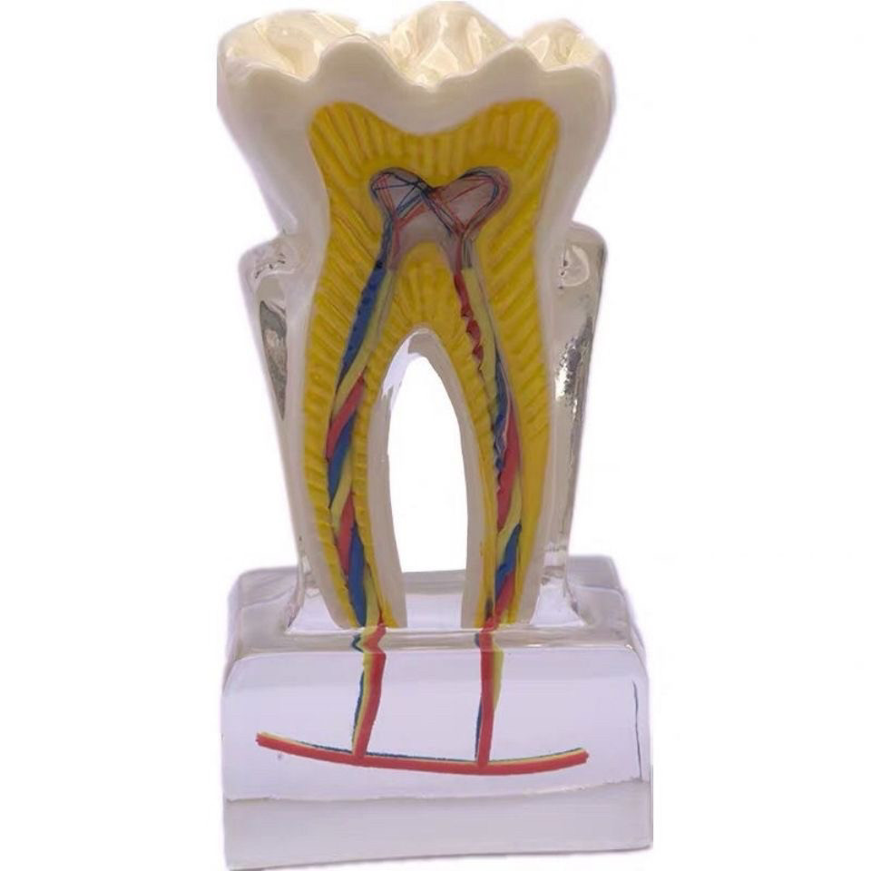 Демонстраційні моделі зуба в розрізі (ID#2295762618), ціна: 1350 ...