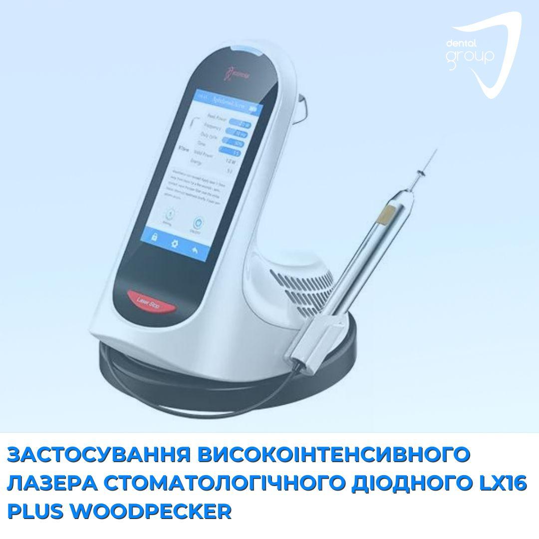 Застосування високоінтенсивного лазера стоматологічного діодного LX16 ...