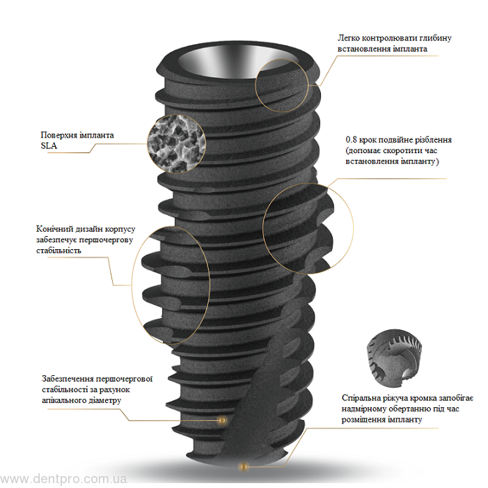 Імплант Izen, цена: 2100 ₴, купить на Prom.ua