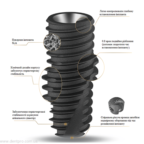Імплант Izen, цена: 2100 ₴, купить на Prom.ua
