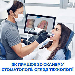 Как работает интраоральный сканер: пошаговое объяснение. Статьи ...