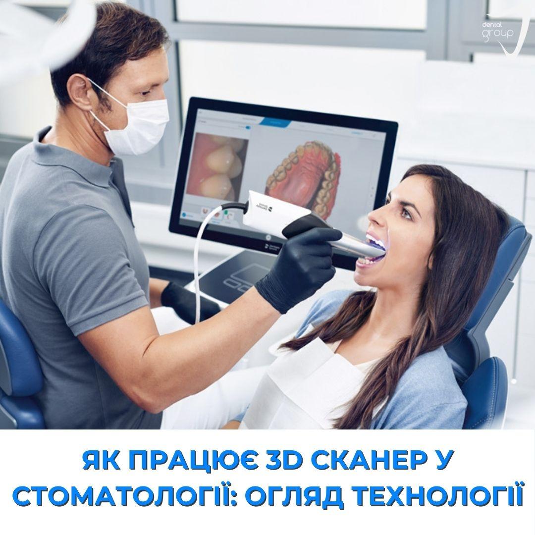 Як працює інтраоральний сканер: покрокове пояснення. Статті компанії ...